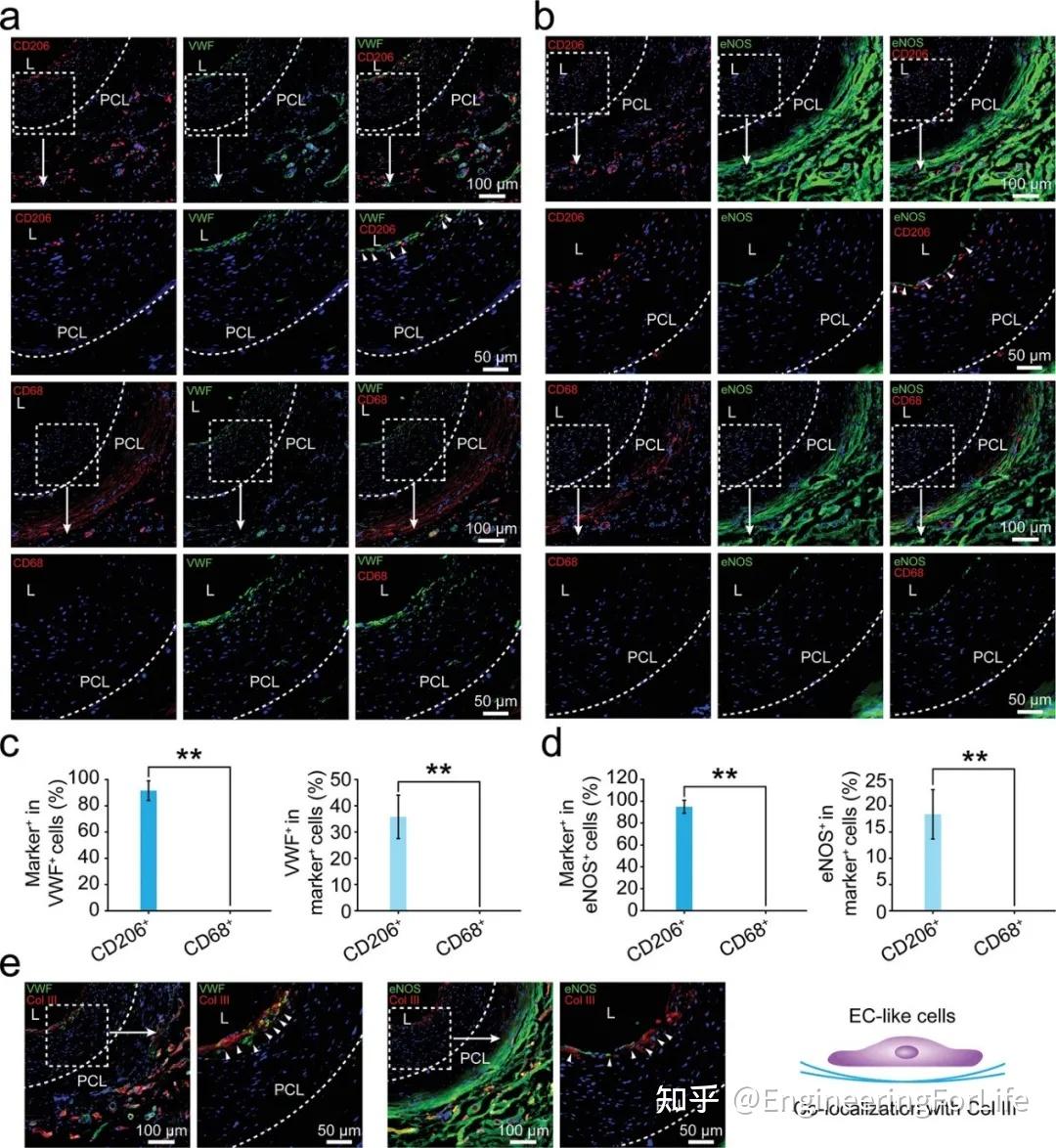 Small： PGS-PCL复合人工血管用于颈总动脉移植 - 知乎