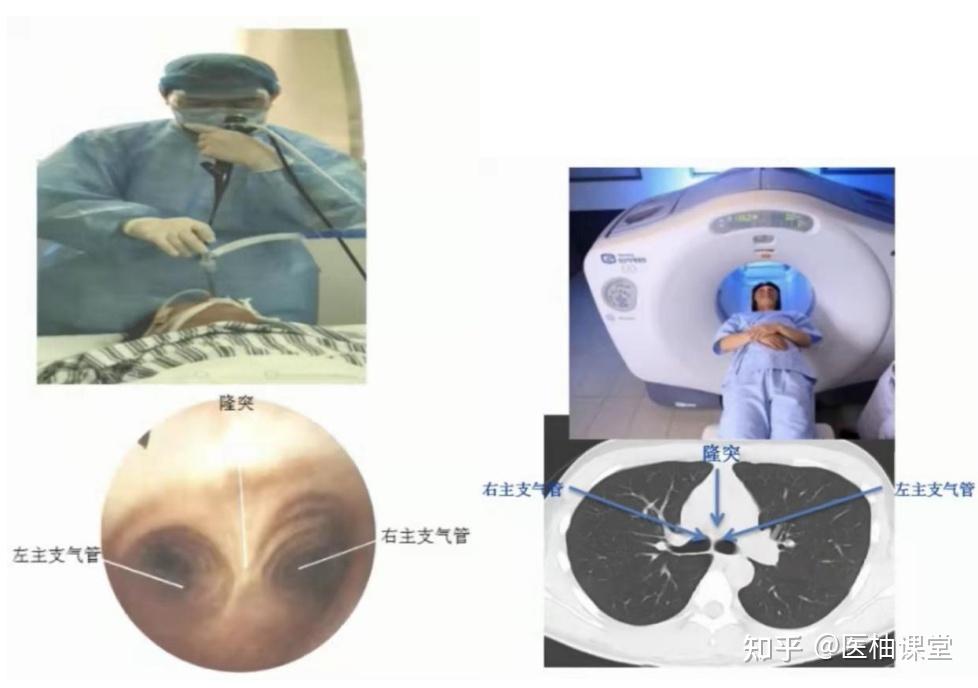 教你读懂胸部CT - 知乎