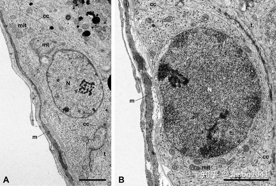 睾丸生精小管的超微结构 - 知乎