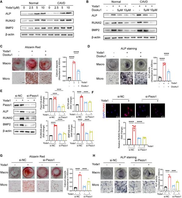 Sci Adv︱南方医科大学曾庆春/许顶立团队揭示Piezo1通过调控谷氨酰胺代谢促进钙化性主动脉瓣疾病发生发展的新机制 - 知乎