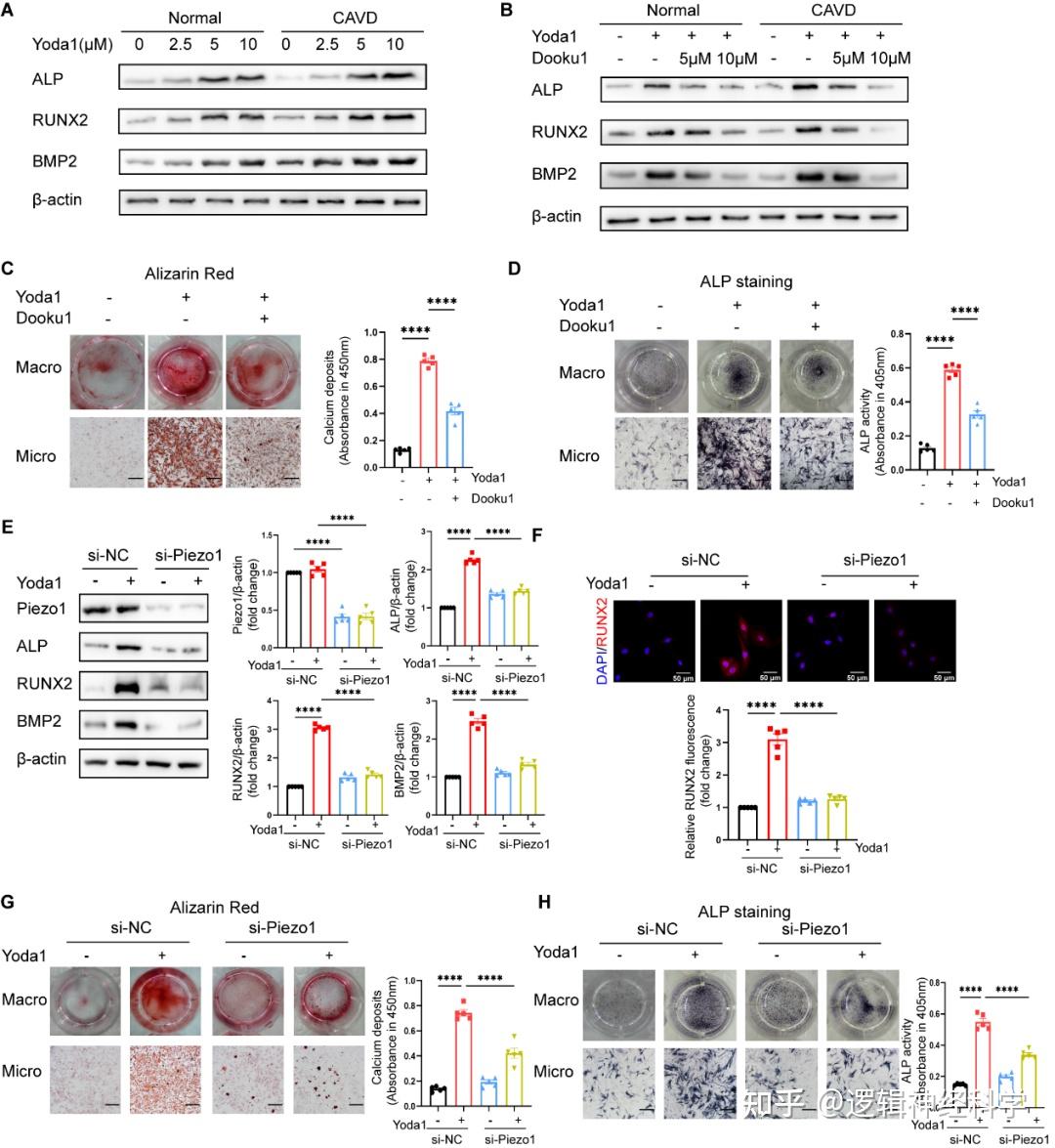 Sci Adv︱南方医科大学曾庆春/许顶立团队揭示Piezo1通过调控谷氨酰胺代谢促进钙化性主动脉瓣疾病发生发展的新机制 - 知乎