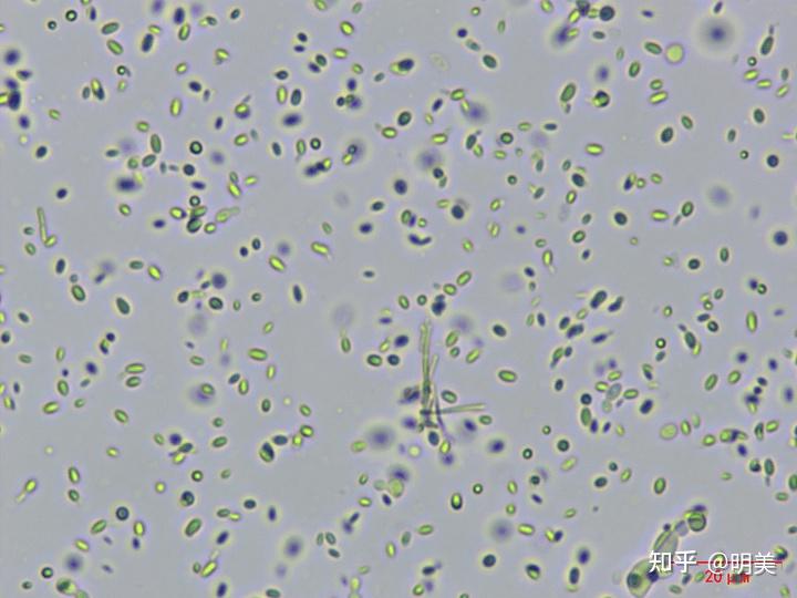 生物显微镜应用于酵母菌观察 - 知乎