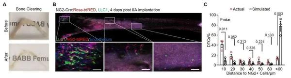Cancer Discov︱张翔团队报道NG2+基质细胞在骨重塑和转移起始中的特殊作用 - 知乎