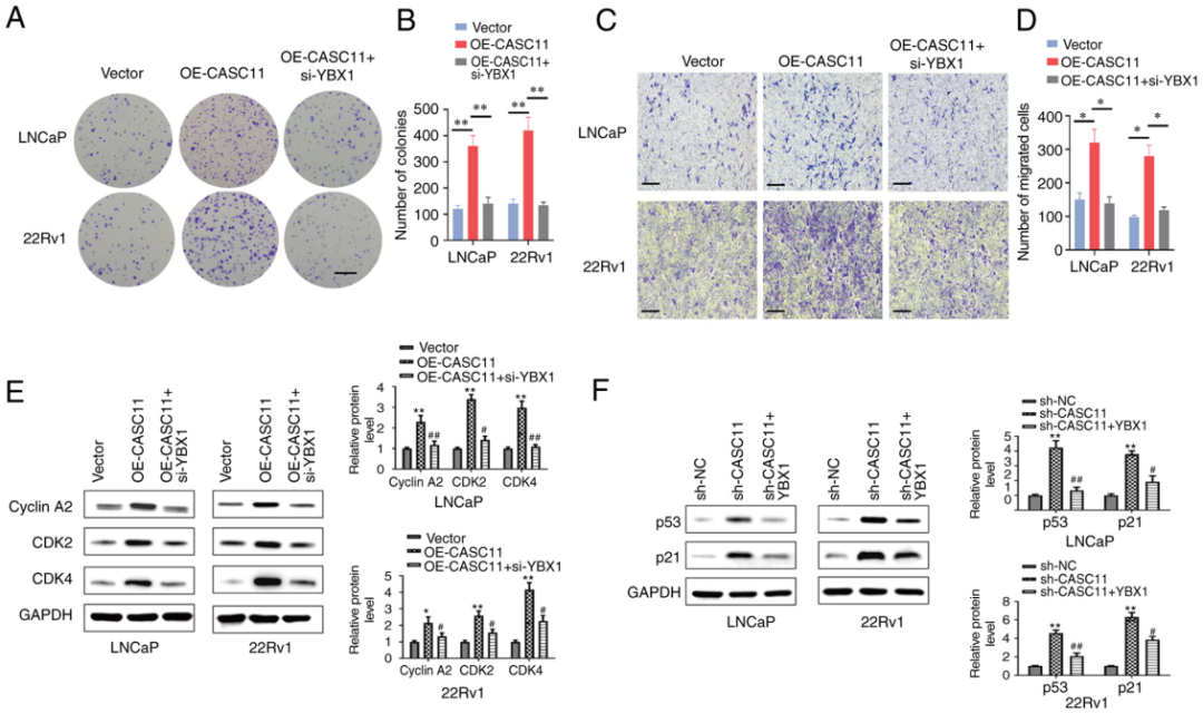 学术助力 | LncRNA CASC11通过与YBX1作用抑制p53途径以促进前列腺癌进展 - 知乎