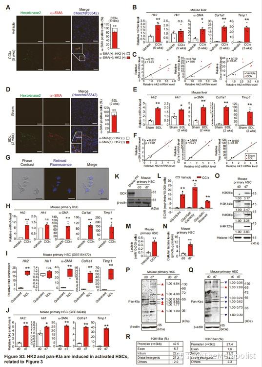 Cell Metabolism ：尊嘟假嘟，组蛋白乳酸化促进肝纤维化？ - 知乎