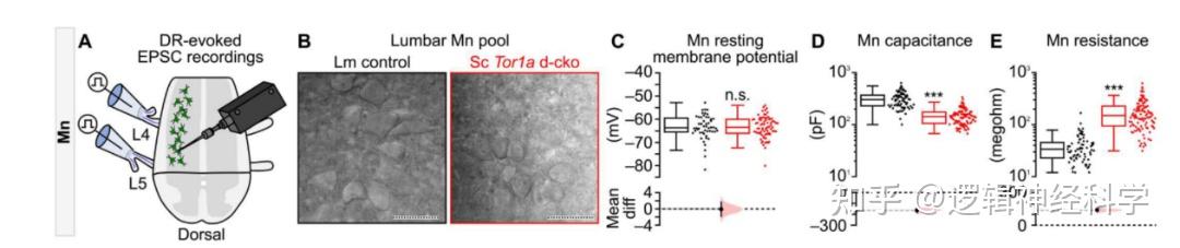 STM︱伦敦大学学院团队发现脊髓神经回路功能障碍介导的Dyt1-Tor1a肌张力障碍小鼠的病理发生机制 - 知乎