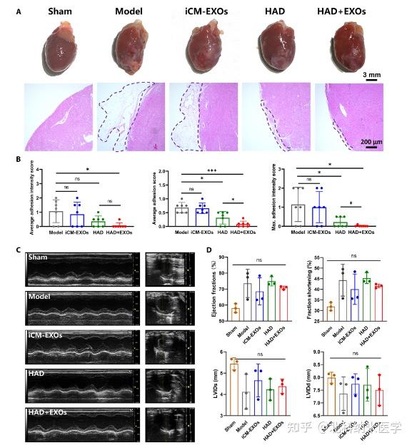 《Sci. Adv.》：可注射光固化Janus水凝胶递送外泌体用于减少心脏手术后粘连 - 知乎