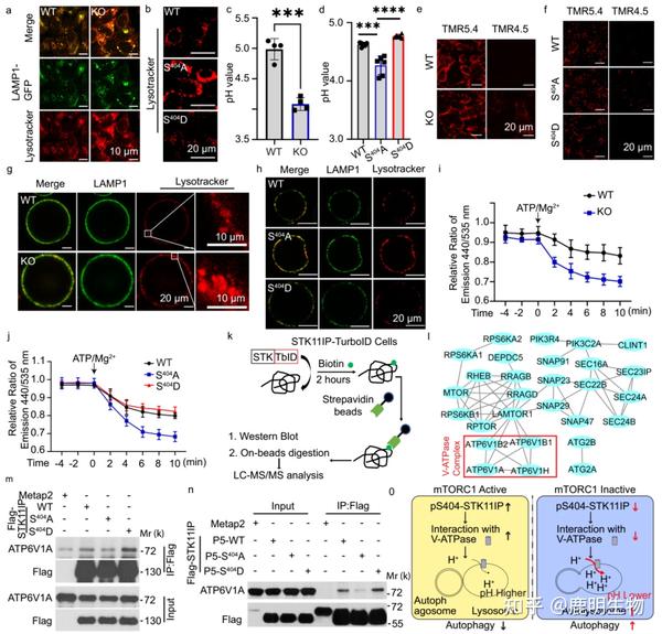 磷酸化+TMT蛋白质组学探究改善自噬信号异常疾病的治疗靶点 - 知乎