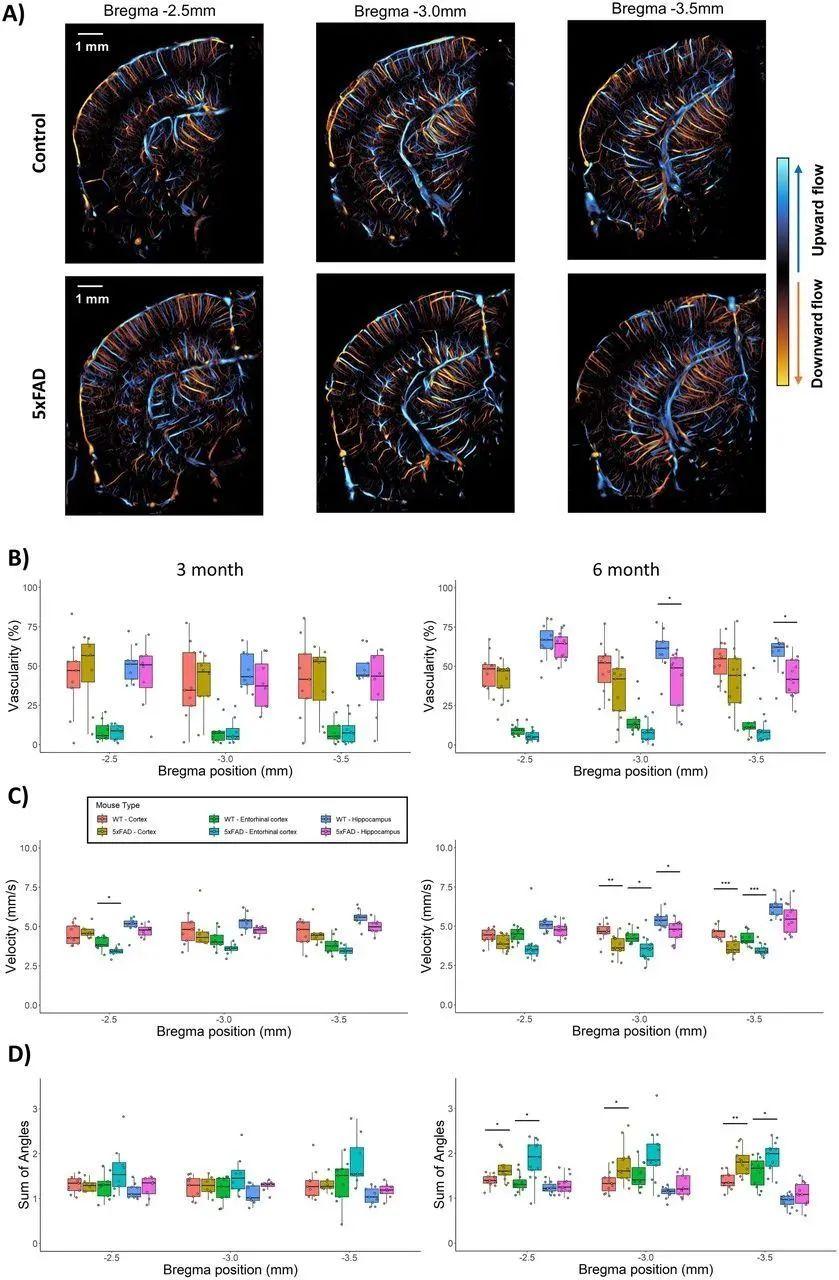 J Neurosci:超分辨率超声 “透视” 阿尔茨海默小鼠脑内血管 - 知乎
