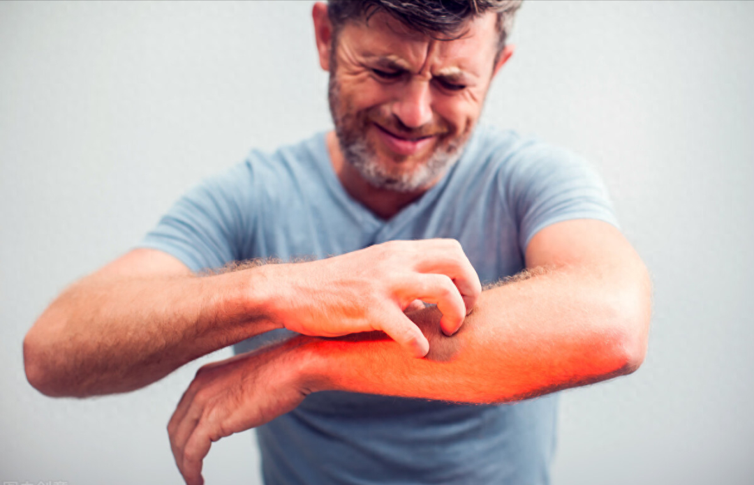 2药养血润燥、化湿解毒、祛风止痒，提高机体免疫、抗炎、抗过敏 - 知乎