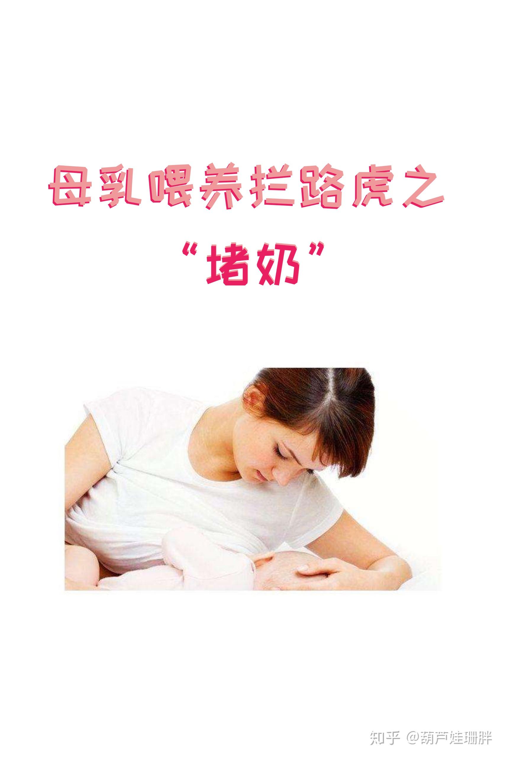 母乳喂养拦路虎之 堵奶” 知乎
