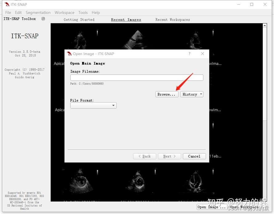 【图像分割】ITK-SNAP分割标注教程 - 知乎