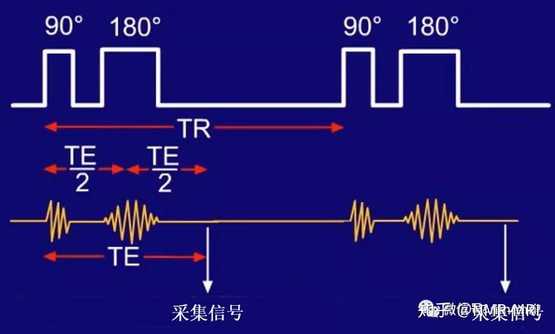 磁共振成像：对PDW T1W T2W 三种加权图像的理解 - 知乎