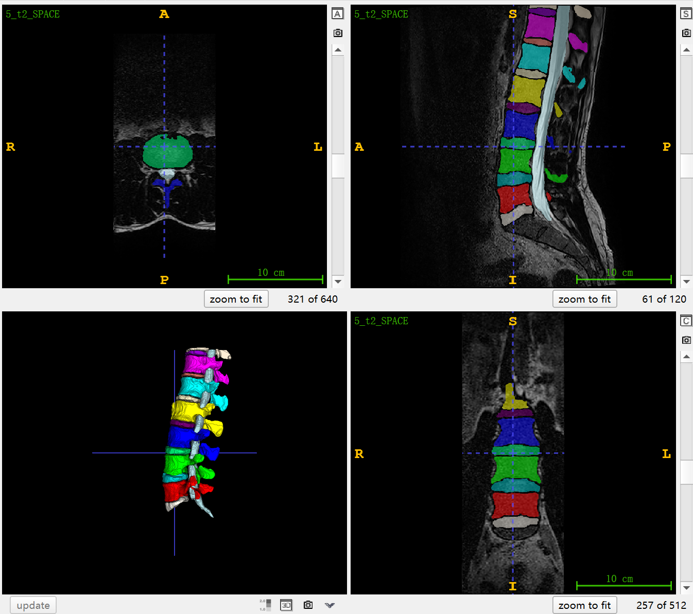 SPIDER 数据集介绍 - 知乎