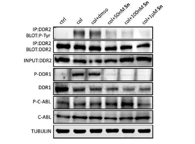 DDR1 和 DDR2 双靶点抑制剂的设计合成及其抗炎作用研究 - 知乎