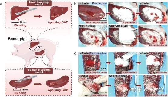 南科大吴德成《AFM》：4-arm-PEG凝胶化粘性止血粉，有效控制致命性出 - 知乎