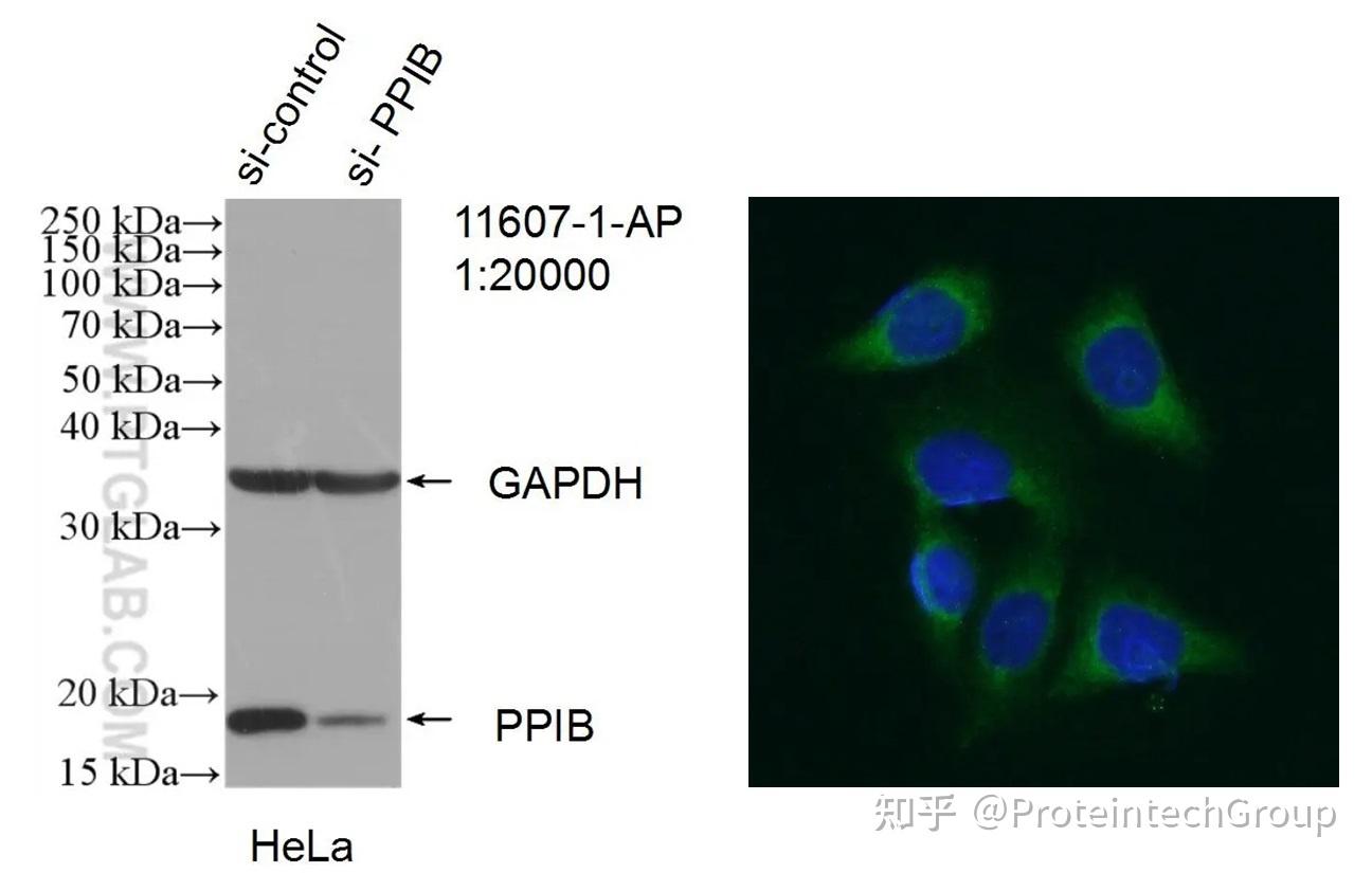 WB指南 | 18种常用WB内参大盘点！码住！ - 知乎