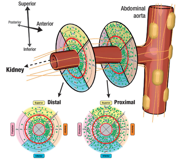 EHJ丨欧洲专家共识声明：RDN在高血压管理中的应用 - 知乎