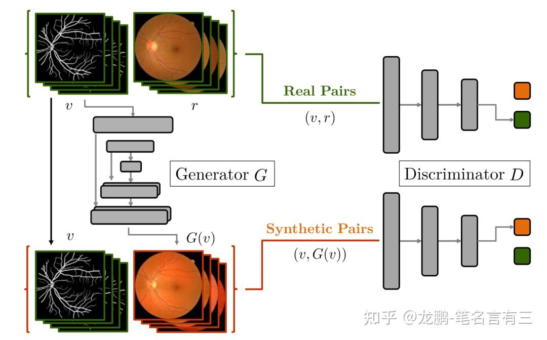 【每周CV论文推荐】GAN在医学图像生成中的典型应用 - 知乎