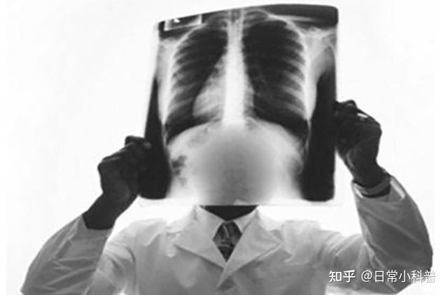 抽烟、喝酒会诱发肺癌，那不抽烟不喝酒怎么会得肺癌呢？ 知乎