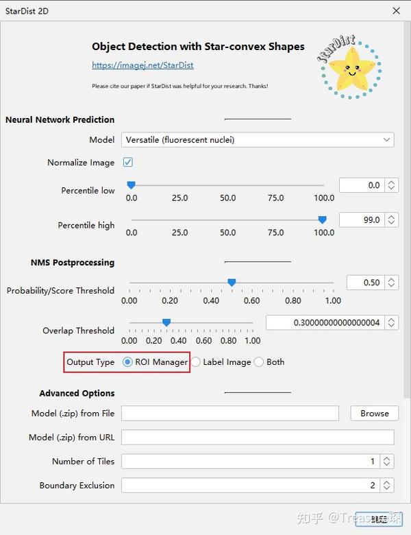 ImageJ实用教程——StarDist批量细胞计数(案例分析篇) - 知乎