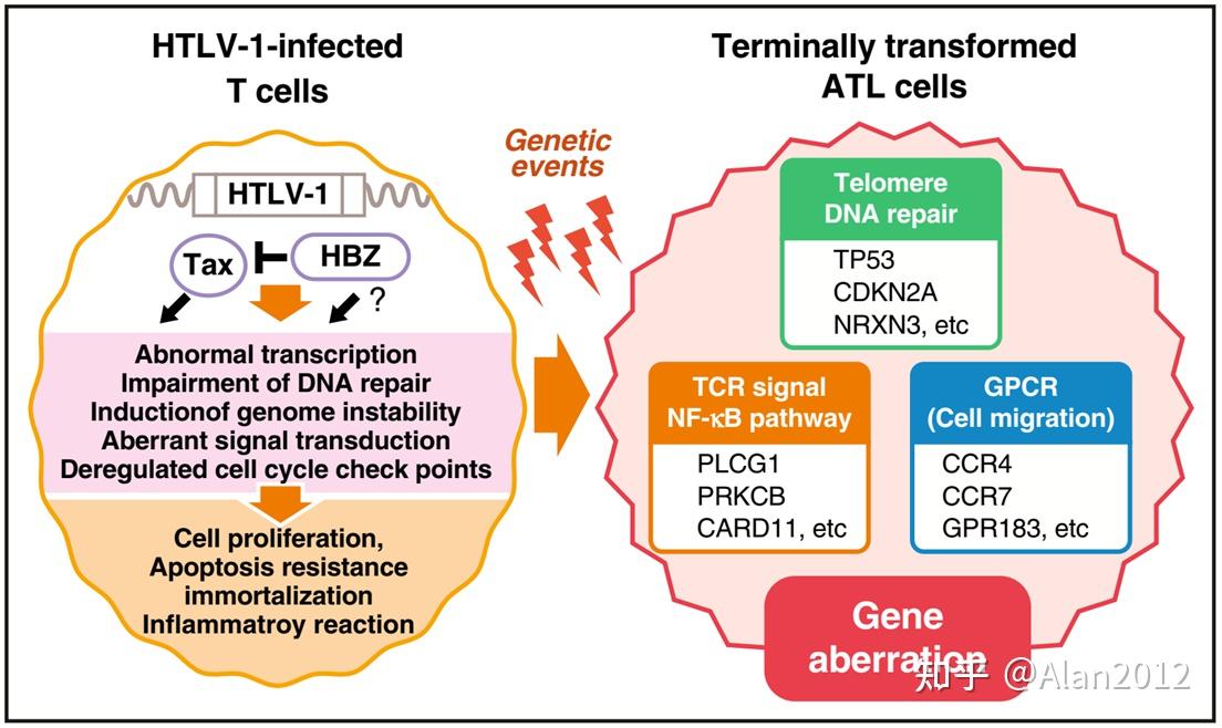成人T细胞白血病（Adult T-cell leukemia，ATL） - 知乎