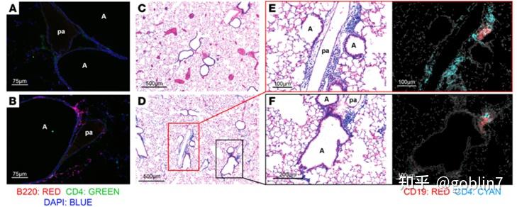 文献阅读——Lung-resident memory B cells protect against bacterial pneumonia - 知乎