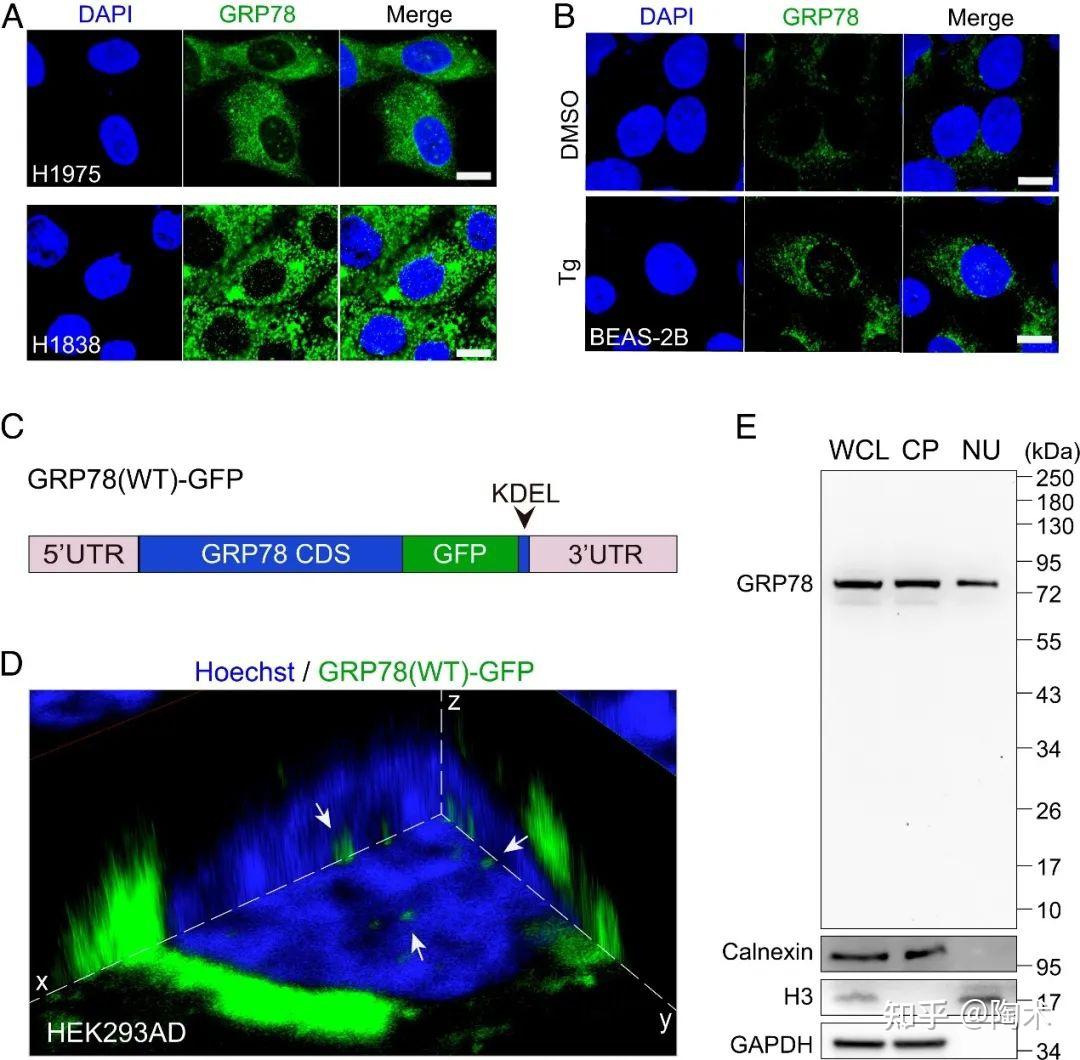 PNAS 重磅 | 一种新型癌细胞转移机制 - 知乎