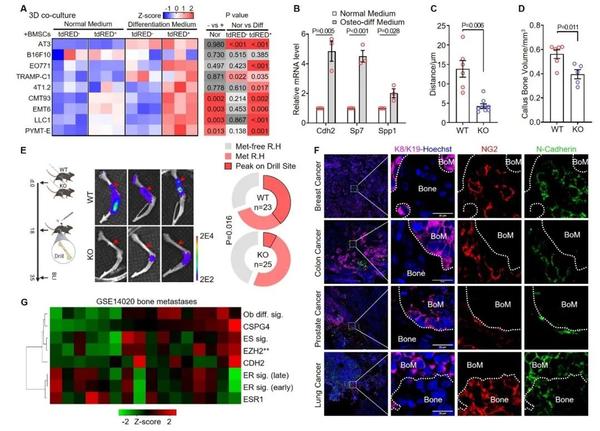 Cancer Discov︱张翔团队报道NG2+基质细胞在骨重塑和转移起始中的特殊作用 - 知乎