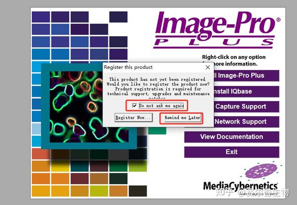 ImageJ？Fiji？Image pro plus？图像处理哪家强？ - 知乎