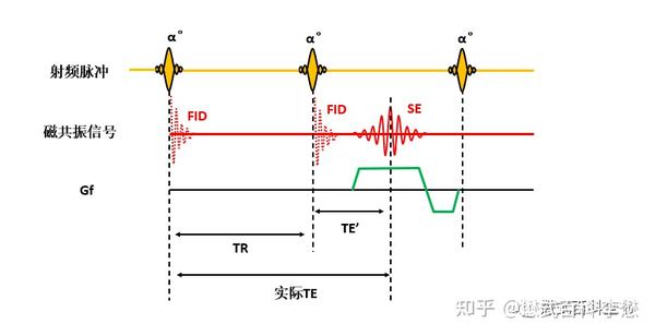 重聚回波SSFP序列 - 知乎
