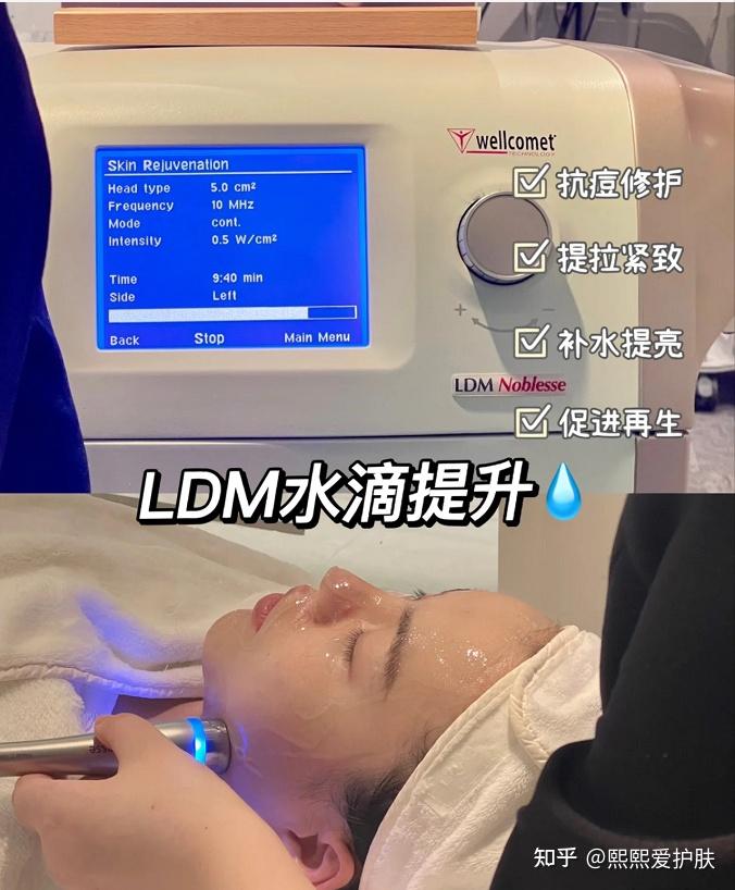 抗老绝绝子韩国HIFU热提拉联合LDM水滴提升 - 知乎