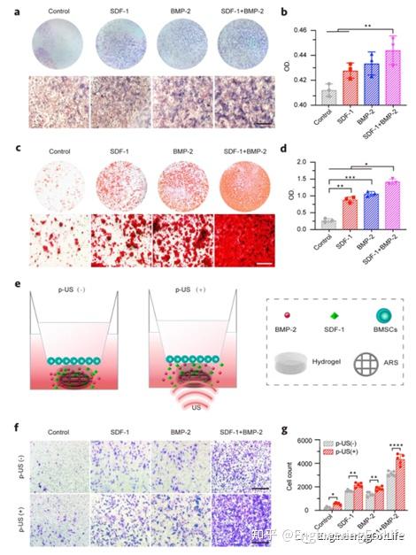《Bioact. Mater.》：声学响应支架募集内源性干细胞用于骨缺损原位修复 - 知乎
