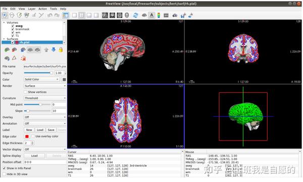 Ubuntu 20.04如何安装最新版本FreeSurfer软件 - 知乎
