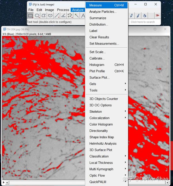 组化片子如何利用Image J 进行阳性信号面积占比统计分析 - 知乎