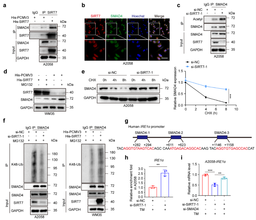 STTT︱空军军医大学李春英团队揭示长寿基因家族成员SIRT7在黑色素瘤发展和免疫逃逸中的作用和机制 - 知乎
