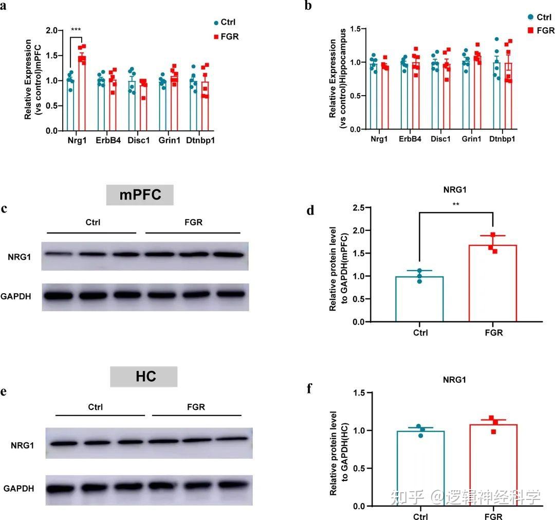Cell Death Discov︱康九红团队发现NRG1有望成为宫内生长受限导致的精神分裂症的治疗新靶点 - 知乎