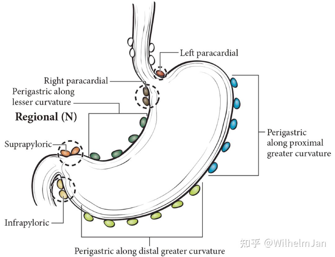 AJCC与JGCA对胃癌区域淋巴结定义的差异 - 知乎