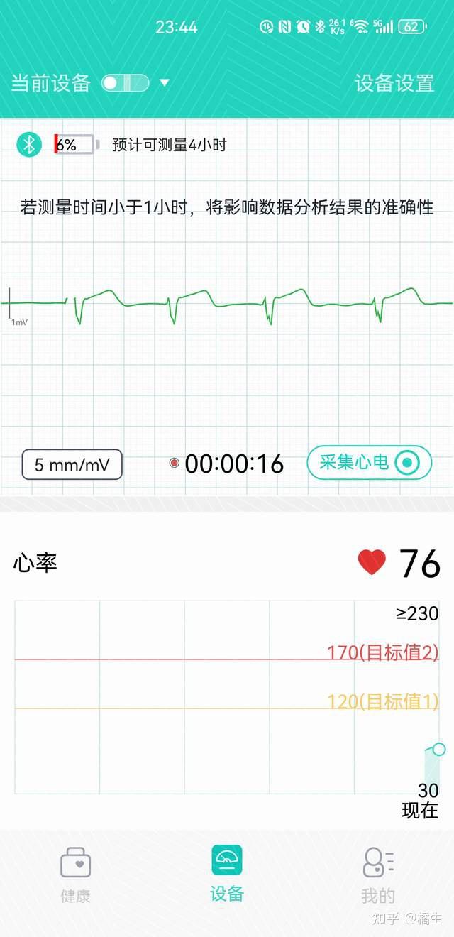 单导联，多导联，心电检测该怎么选择？这次我都体验了一遍！ - 知乎