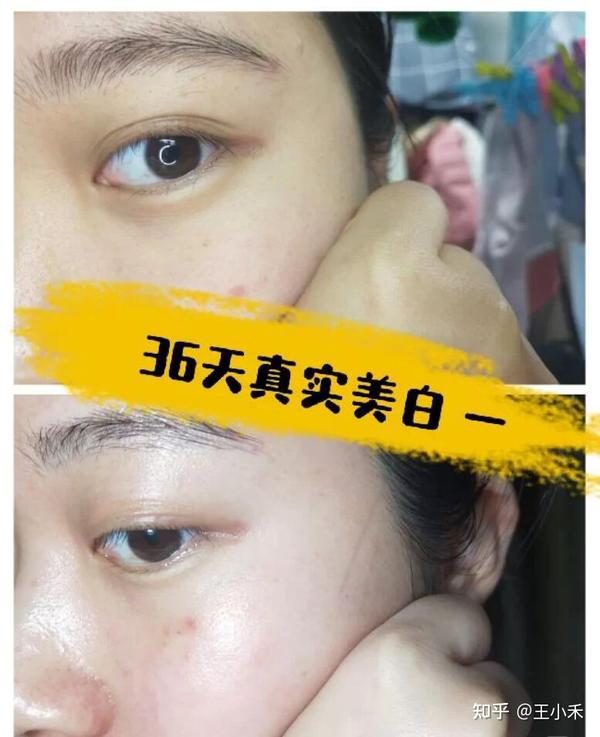 目前为止你用过最满意的美白精华是什么? 知乎