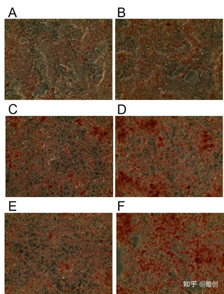 AML-12 细胞小鼠正常肝细胞高脂细胞模型建立以及油酸、棕榈酸BSA（游离脂肪酸）造模（非酒精性脂肪性肝病）数据分享 - 知乎