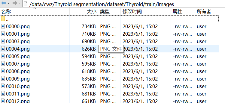 nnunet v2训练自己的数据集 - 知乎