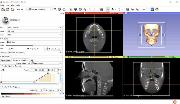 3D Slicer——选择感兴趣区，输出为DICOM序列 - 知乎