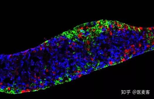 ViaCyte改进“现货”糖尿病新型疗法，皮下植入干细胞衍生胰岛细胞代替疗法有效避免宿主免疫排斥反应 - 知乎