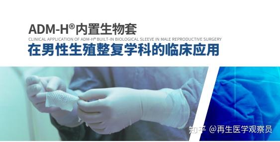 应用ADM-H内置生物套技术不影响神经 - 知乎