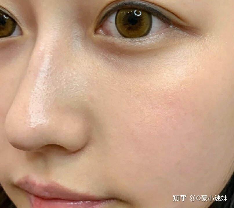 为啥我强烈建议想要快速美白时,一定要用涂抹式美白针?! 知乎