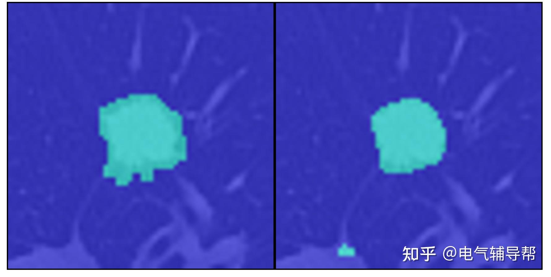 3 D V Net 3D Matlab 3-d-v-net-3d-matlab