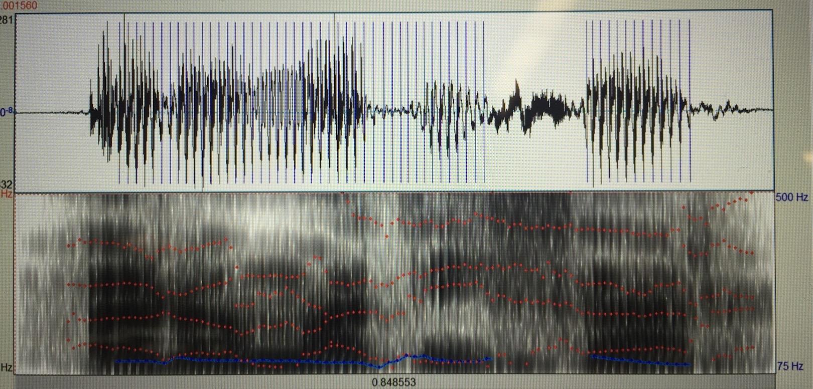 关于 Praat 的 spectrogram 怎么来区分辅音？ - 知乎