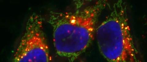ImageJ实用技巧——平均荧光强度检测(定量分析篇) - 知乎