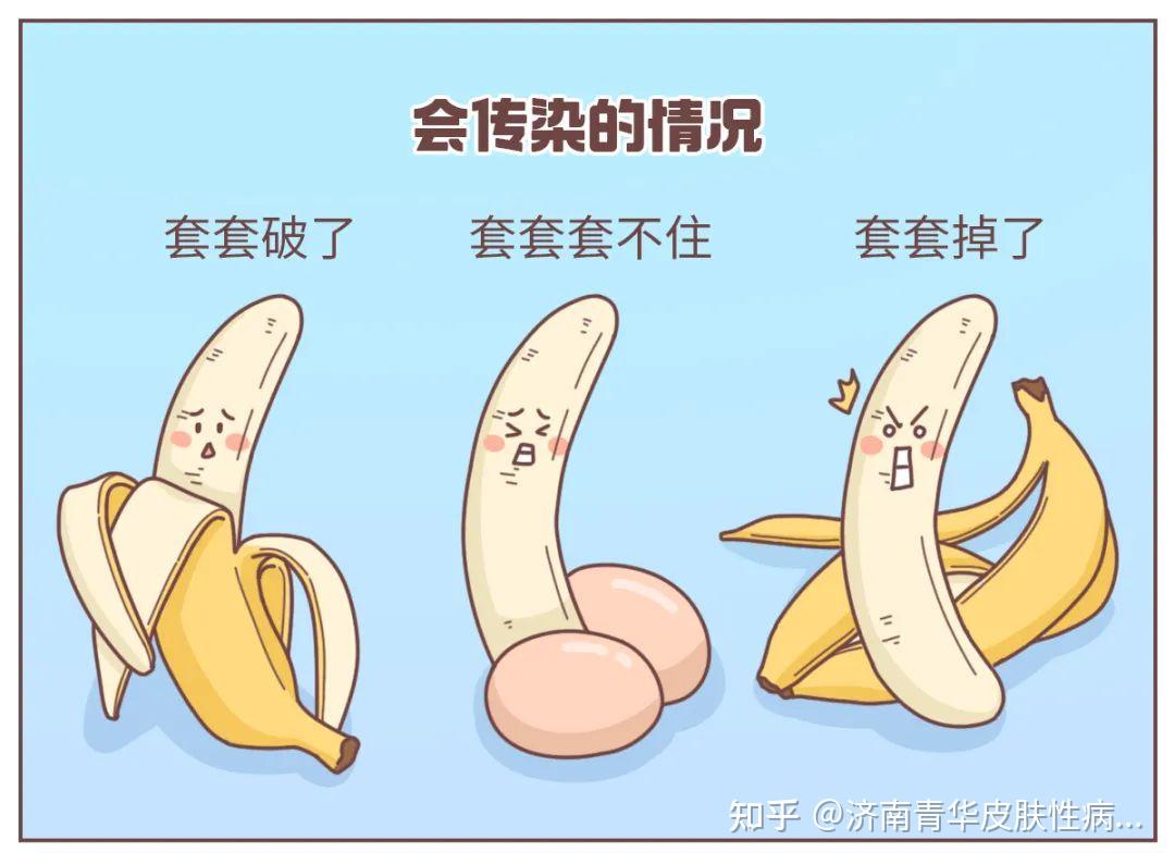 Hpv感染注意事项!女生一定要注意这些 知乎